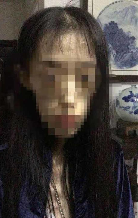 21-Year-Old Anorexic Woman Finally Wakes Up From 40 Days Coma After ...