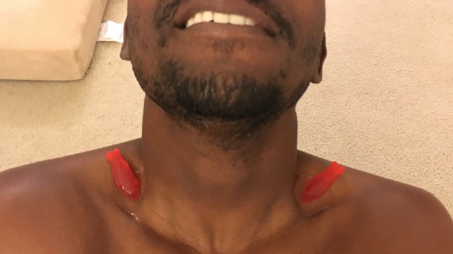 [Fish In Collarbone] The New 'How-Skinny-Are-You' Measurement