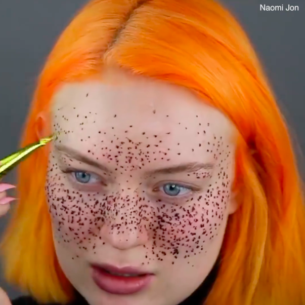 She Thought Henna Can Mask Her Acne Scars But It Turns Out DIsastrous!