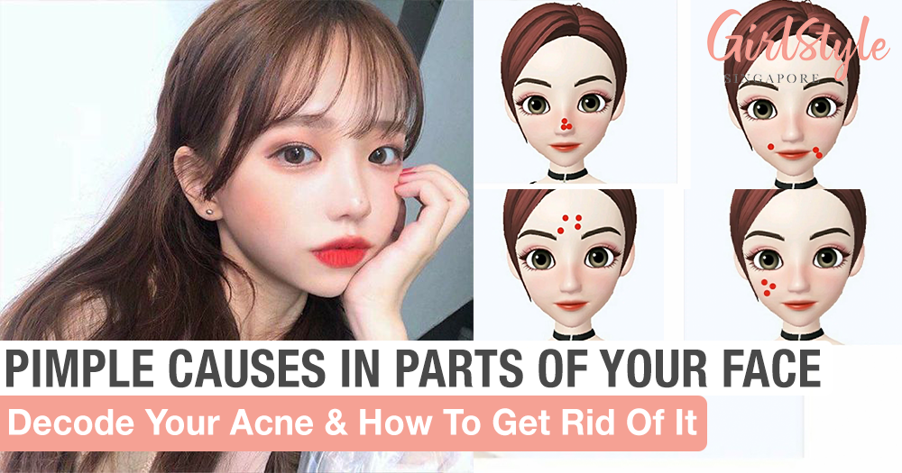 Pimples On In Certain Areas Of The Face: Causes & How To Get Rid Of It