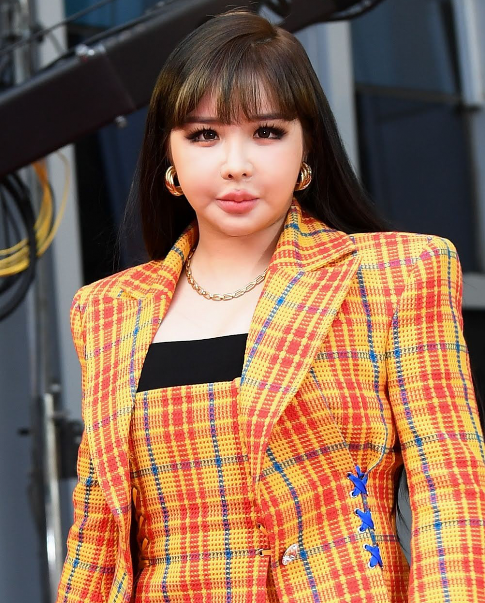 Park Bom's New Facial Features Sparks Netizens Worried Comments