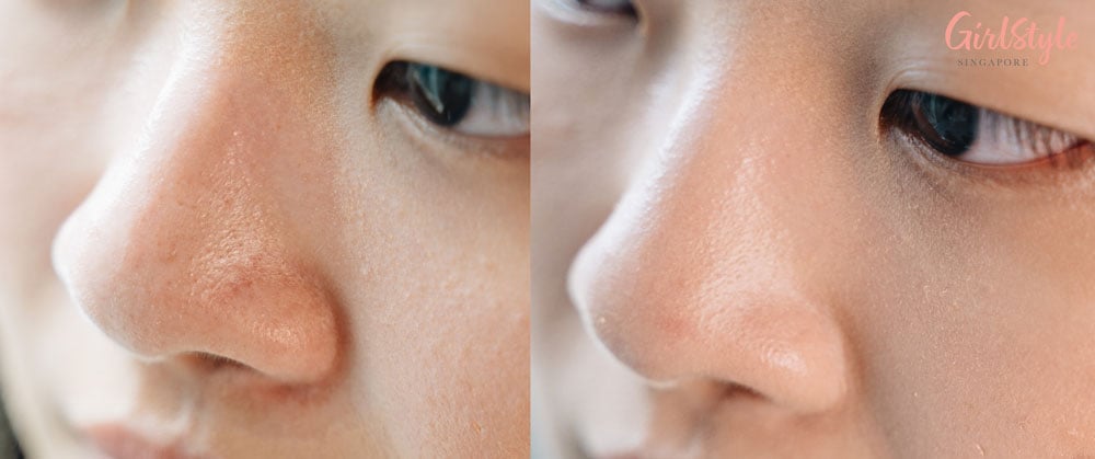 Skin Problem Causes & How To Get Rid Of Them