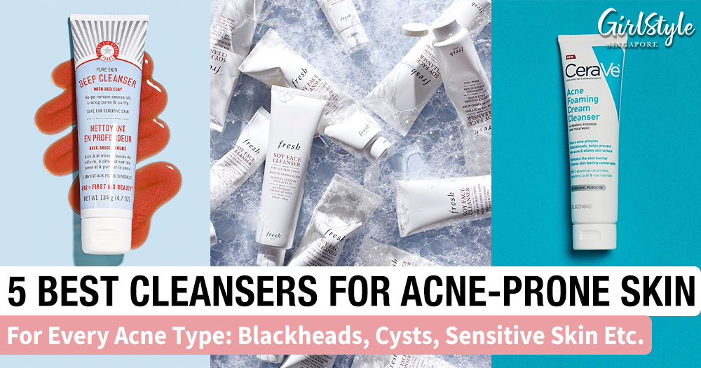 Best Facial Cleansers For All Types Of Acne-Prone Skin In Singapore