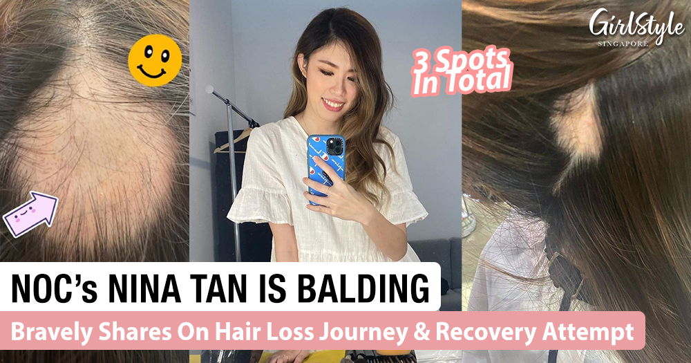 NOC's Nina Tan Is Balding, Shares Hair Loss Journey & Jokes Despite ...