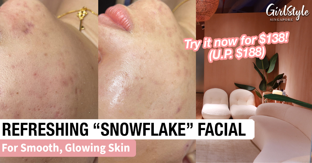 This Refreshing “Snowflake Facial” At Nap & Glow Gave Me Smooth Glowing ...