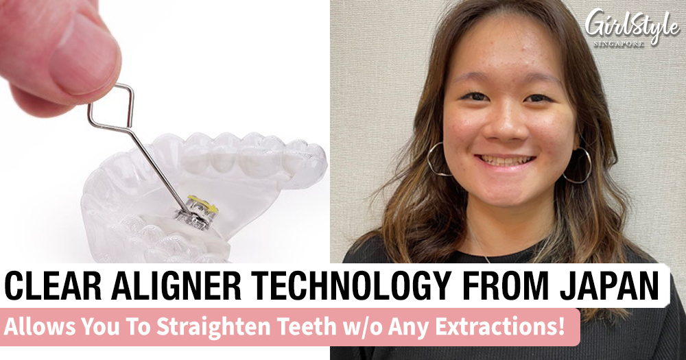 KIYOCLEAR: 5 Facts About This Latest Clear Aligner Technology From Japan