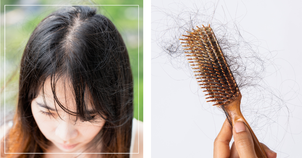 Stress Made My Hair Fall Out, And Here's The $40 Topp Care Hair Loss ...