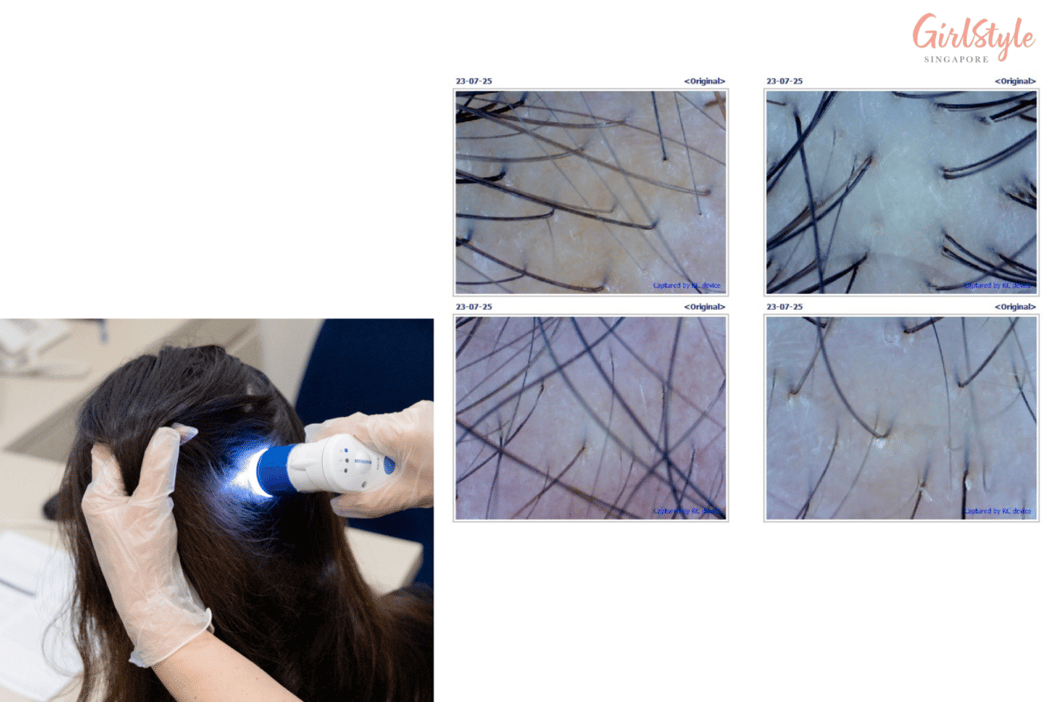 TK TrichoKare Scalp Purifying Therapy Review