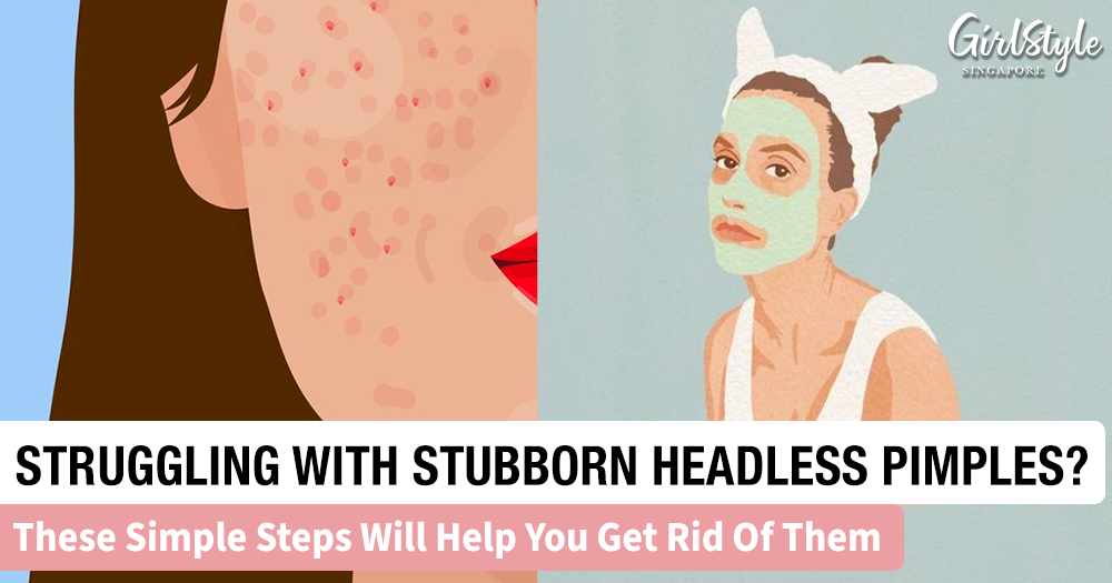 How To Get Rid Of Blind Pimples Effectively