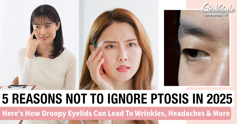 5 Reasons Why You Shouldn’t Overlook Ptosis (Droopy Eyes) This Year