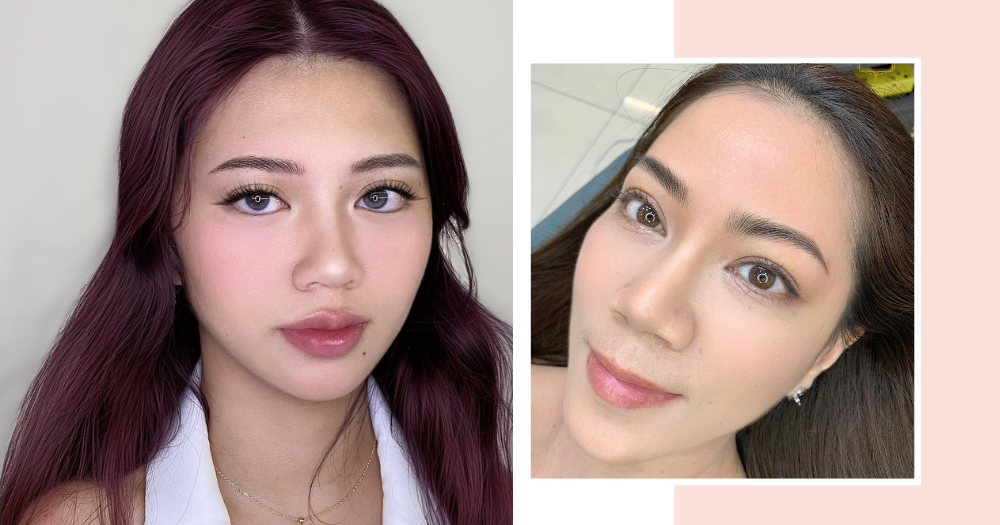 World's Biggest lips: Woman Goes Viral After Getting 20 Lip Injections